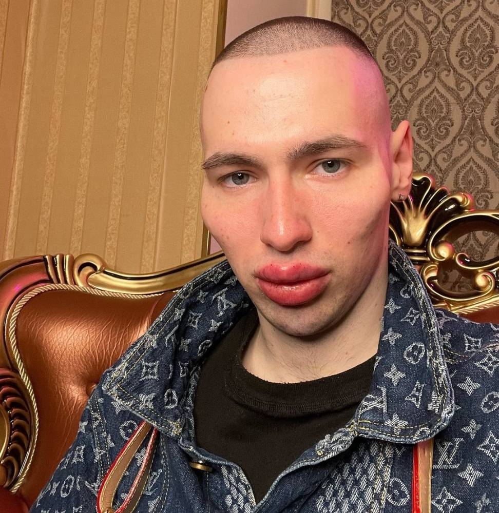 Former Russian soldier undergoes surgery to become an ‘alien’ after ...