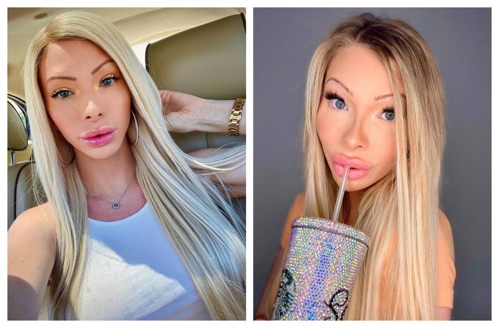 American woman who spent over RM200,000 on plastic surgery says it ...