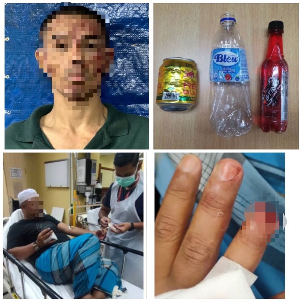 Suspect under drug influence bites off cop’s finger in Kuala Lumpur ...