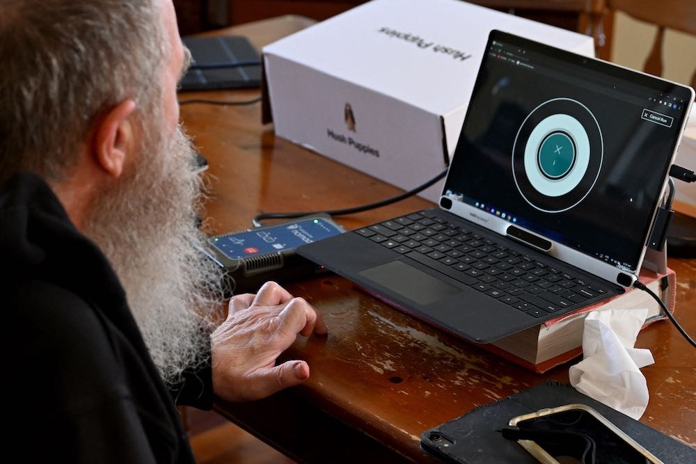 ALS patient pioneering brain-computer connection | Malay Mail