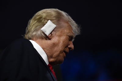 Trump’s ear injury update: Former White House doctor provides detailed ...