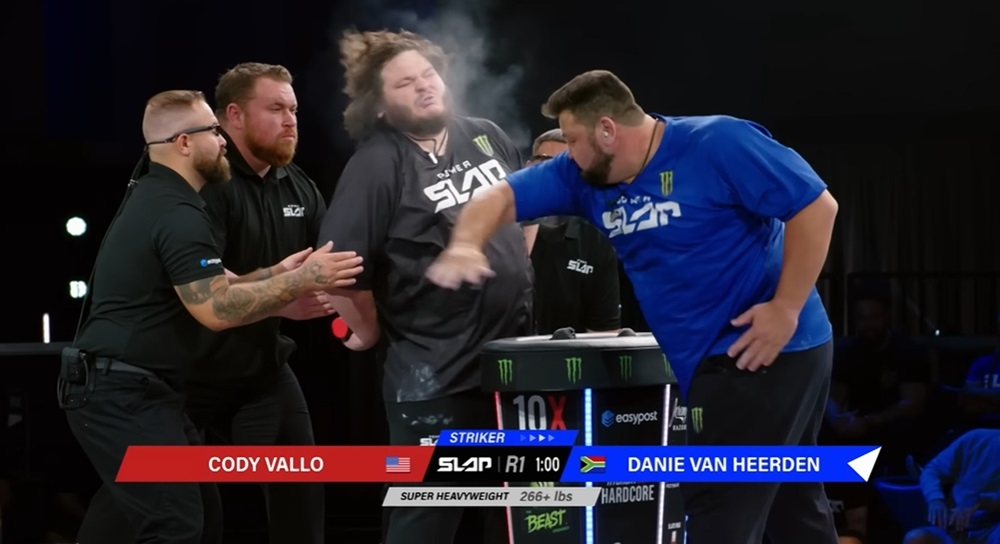 Slap fighting causes high risk of brain injury, doctors call for ...