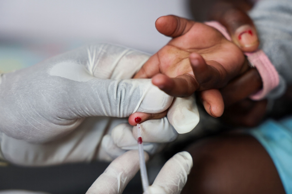 HIV infections could surge worldwide as US pulls funding from global ...