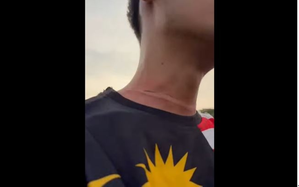 Kite string slices motorcyclist’s neck in freak accident on MRR2 near ...
