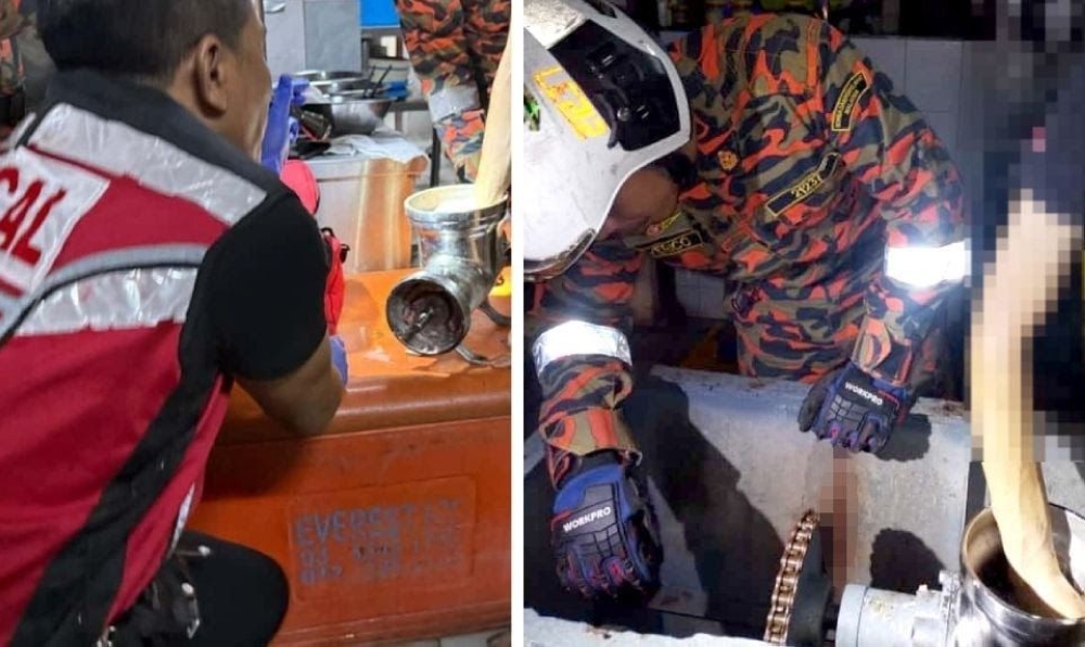 Meat grinder horror leaves man fighting for his hand in Chemor | Malay Mail