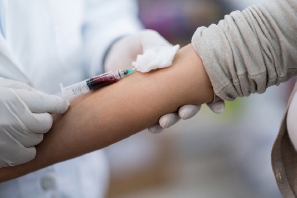 Australian researchers develop blood test to detect concussion in older ...